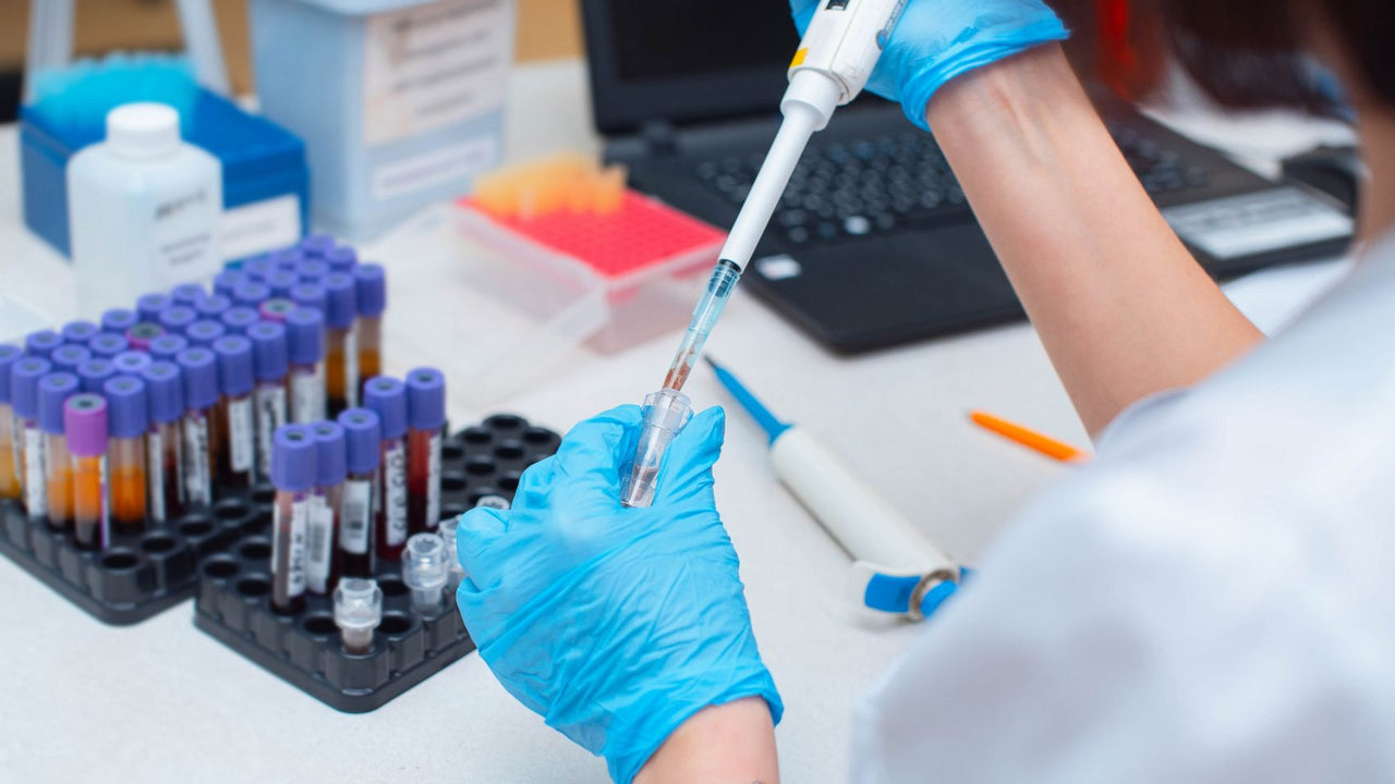️ Blog sobre Reactivos, Materiales y Equipos de Laboratorio Clinico ...